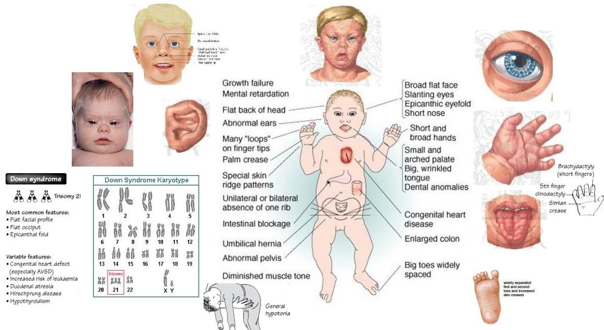 هل يمكن للام الحامل أن تعرف أن الجنين مصاب